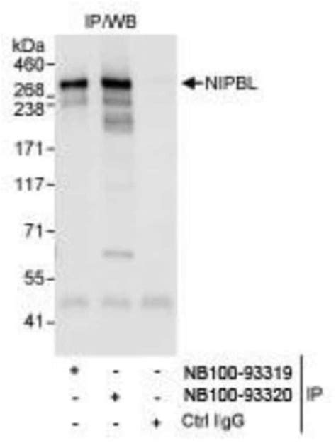 Nipbl Antibody 01ml Unlabeledantibodies Polyclonal Fisher Scientific