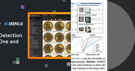 List Anomaly Curated By Davidchoi Medium