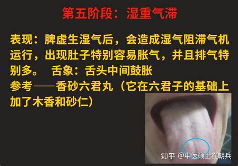 脾气虚脾阳虚由轻到重看看自己的脾虚在哪个阶段12个阶段的脾虚一次讲明白 知乎