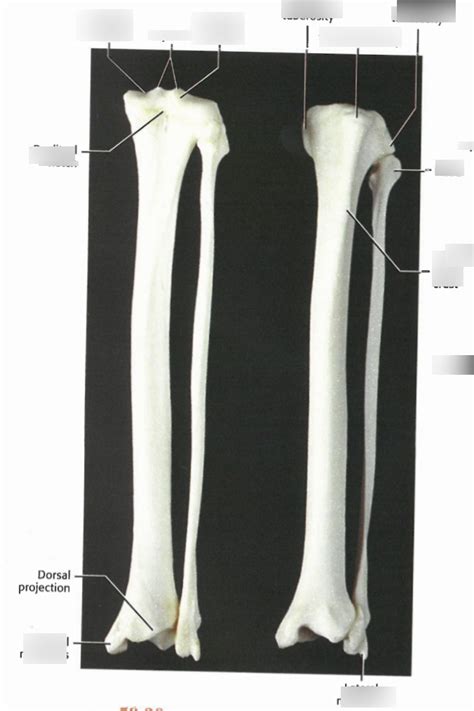 Cat Tibiafibula Diagram Diagram Quizlet