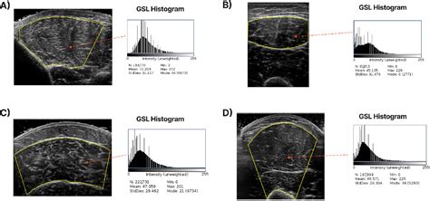Figure From Muscle Cross Sectional Area Segmentation In Transverse Ultrasound Images Using