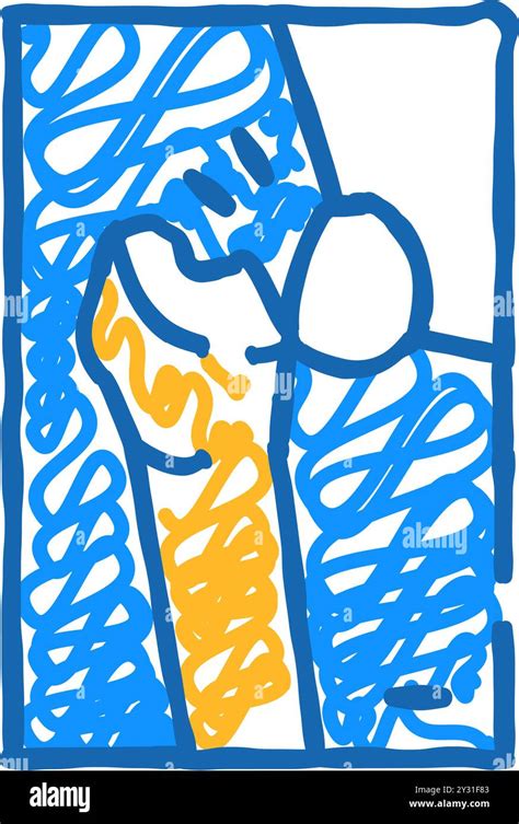 Hip Fracture X Ray Icon Doodle Illustration Stock Vector Image And Art Alamy