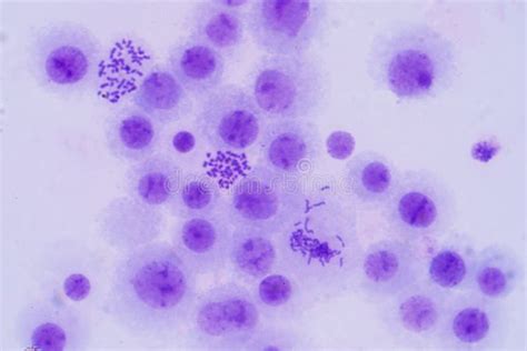 Human Chromosomes Under Microscope View Stock Image Image Of