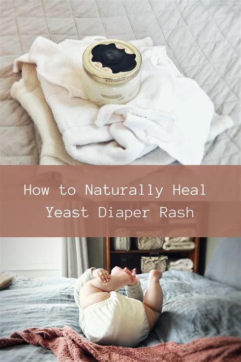 How To Naturally Heal Yeast Diaper Rash Natural Diaper Rash Treatment