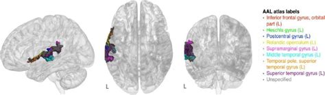 Operculum Brain Of The L