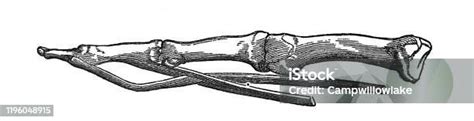 Ilustrasi Antik Tulang Metacarpal Dan Falangeal Jari Dengan Tendon Dan Ligamen Ilustrasi Stok