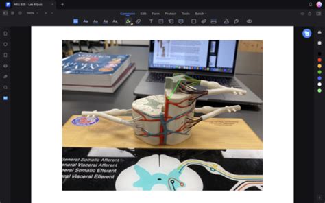 Lab Quiz Flashcards Quizlet