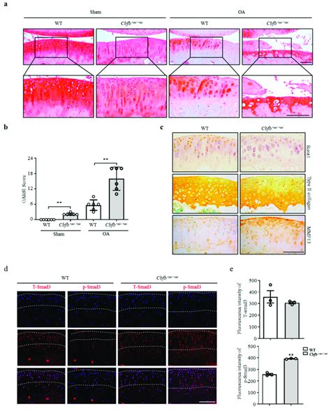 Deletion Of Cbfb In Articular Chondrocytes Accelerated Oa Pathogenesis Download Scientific