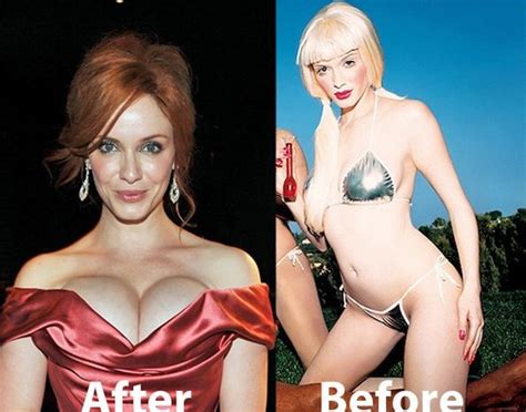 Christina Rene Hendricks Before And After Plastic Surgery Celebrity Plastic Surgery Online