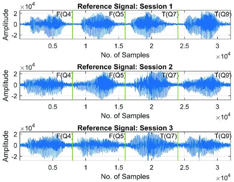 Reference Speech Signals Download Scientific Diagram