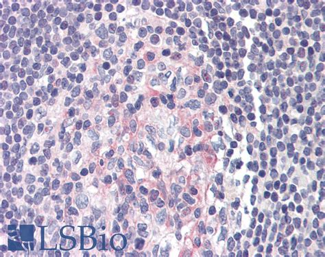 Ihc Plus™ Nfkbib Ikb Beta Ikbb Polyclonal Antibody Rabbit Lsbio