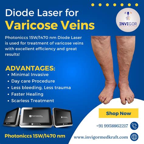 Diode Laser For Piles In India Invigor Medkraft Medium