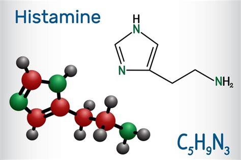 Histamine Reaction Vectors And Illustrations For Free Download