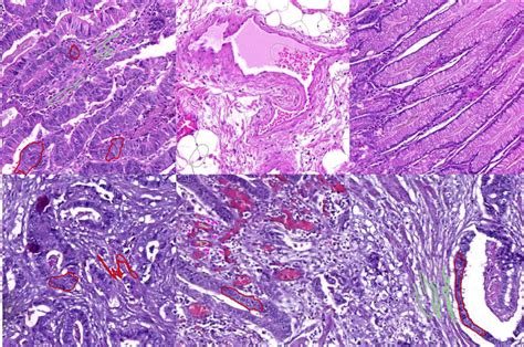 Qupath Pixel Classification And Cpu Usage And Issues Imagesc Forum