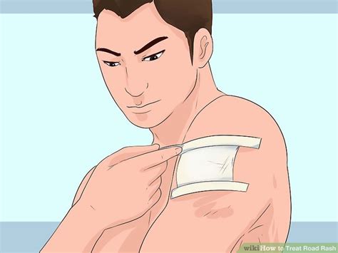 How To Treat Road Rash With Pictures WikiHow