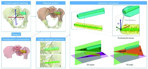 Overview Of The Method Used To Determine The Implant Deviation Between