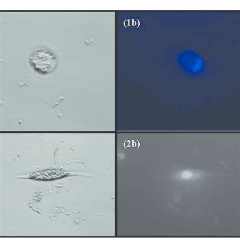 1 5 Examples Of Fibroblast Cells And 6 A Representative Epithelial Download Scientific