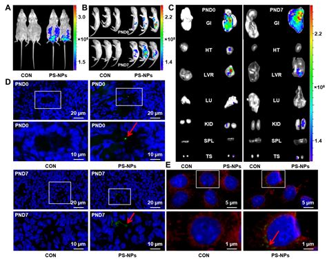 Acs Nano—李新红课题组发文揭示母体暴露于纳米塑料破坏后代雄鼠精子发生的分子机制 研究成果