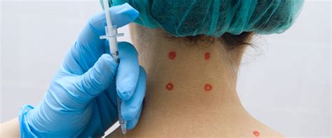 Do Trigger Point Injections Have Side Effects