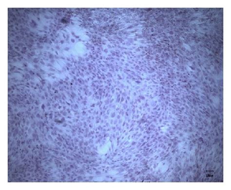 Immunohistochemical Staining Of Mscs Cd 44 Positive Marker A Cd 29 Download Scientific