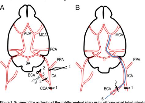 Figure 2 From Mouse Model Of Intraluminal Mcao Cerebral Infarct