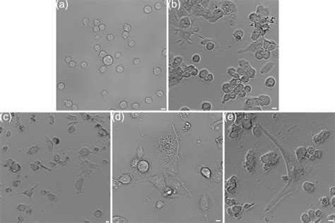 1 Micrographs Of Various Phenotypes Of Thp 1 Derived Cells A Thp 1 Download Scientific