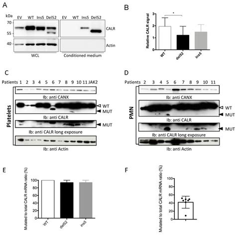 Calreticulin Calr Mutant Proteins Are Substrates Of Endoplasmic Download Scientific Diagram