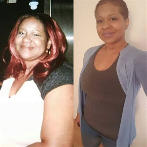 Phentermine Results Before And After Weight Loss