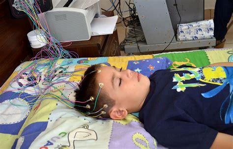 Electroencefalograma Eeg