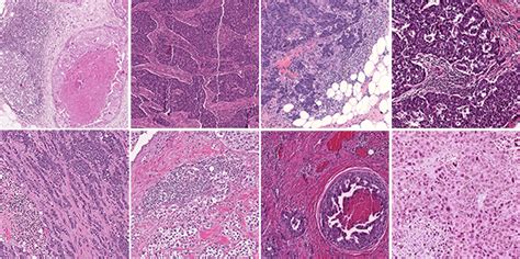 Demonstration Of Tumor Heterogeneity Download Scientific Diagram