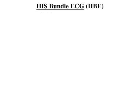 Ppt His Bundle Ecg Procedure Waves Intervals And More Powerpoint Presentation Id 8978606