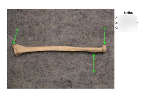 Radius Diagram Quizlet
