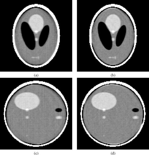 Figure 1 From Art For Helical Cone Beam Ct Reconstruction Semantic