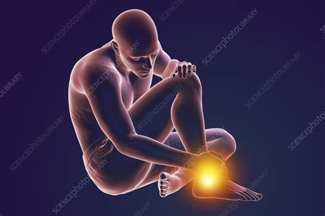 Man With Ankle Pain Illustration Stock Image F0375350 Science