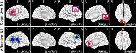 The Sloreta Source Localization For The Difference Waves Incongruency Download Scientific