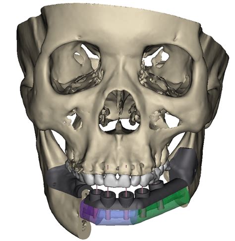 种植设计 深圳市北辰星医疗科技有限公司