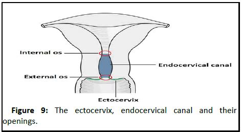 Immunohistological Analysis Of Cervical Cancer In Patients