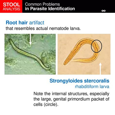 Common Problems Of Parasites Identification In Stool Analysis Pdf