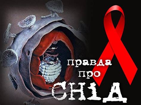 Презентація на тему Снід варіант 4 — презентації з біології Gdz4you