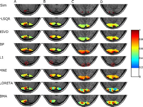 Figure 2 From Comparison Of Source Localization Techniques In Diffuse