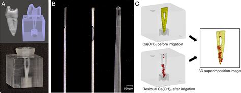 Efficacy Of Different Irrigation Needles And Ultrasonic Activation On Calcium Hydroxide Removal
