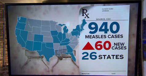 Us Measles Outbreak 2024 Glenn Kalinda