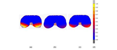 Distribution Of Contact Pressure At The Bottom Of Breasts With Bra Cup Download Scientific