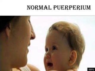 Puerperiumsreelakshmi Pptx