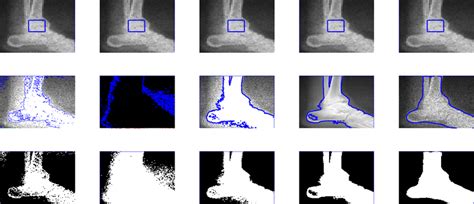 First Second Third And Fourth Columns Are The Segmentation Results Of