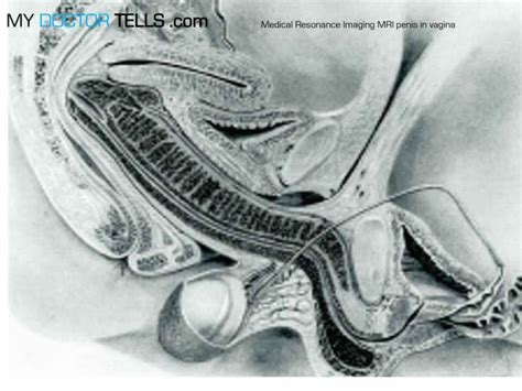 X Ray Penis Entering Vagina Cumception