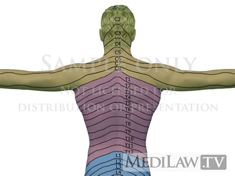 Rheumatology Images Cervical Dermatome Anatomy 04 Flickr Photo Sharing