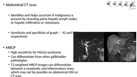 Management And Diagnosis Of Mirizzi Syndrome Pptx