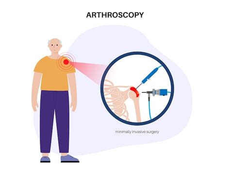 Premium Vector Shoulder Arthroscopy Procedure For Elderly Man Rotator