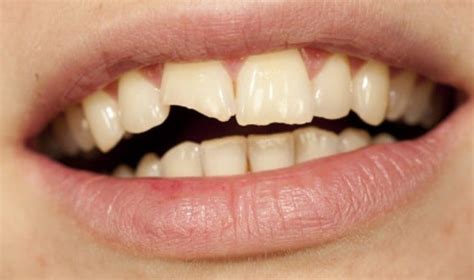 Teeth Talk Girl Trusted Oral Health Information